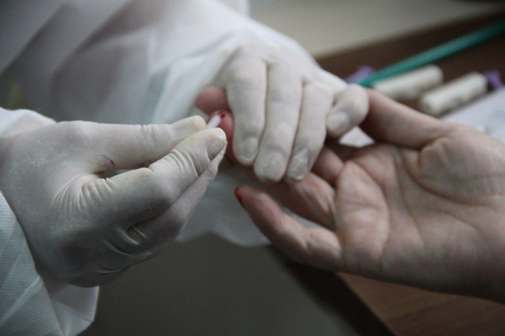 Secretaria de Saúde limita a 80 testes diários exames de pessoas ...