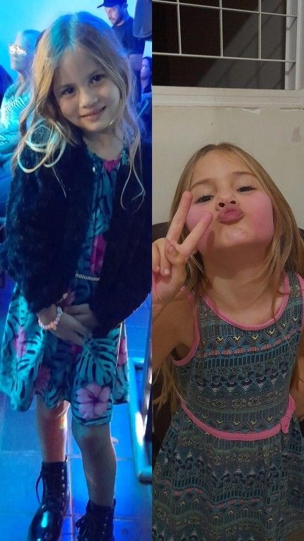 Família busca apoio para tratamento de Ana Lívia em São Paulo